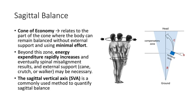 The Importance of Sagittal Balance in Adult Spinal.pptx