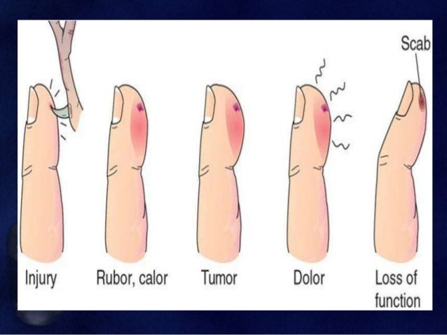 The inflammatory process