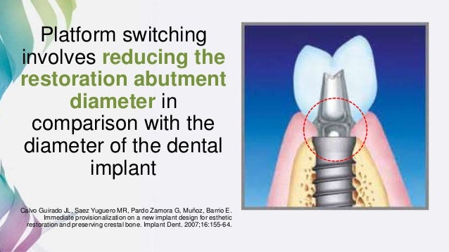 The influence of platform switching in dental implants