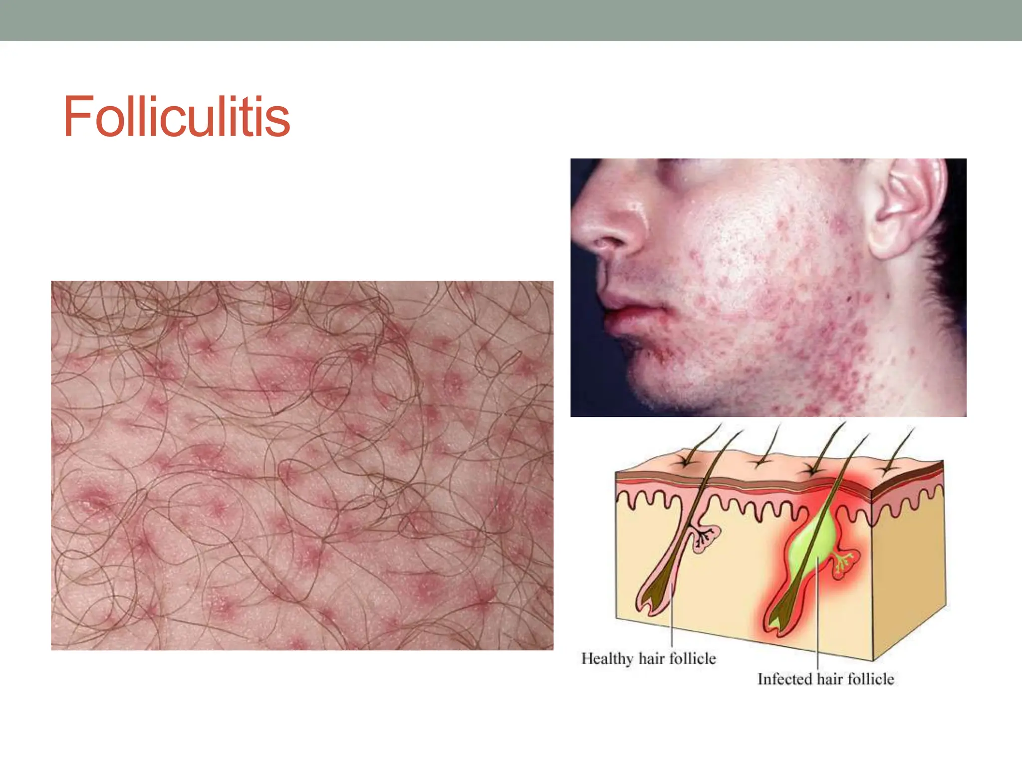 The Integumentary System Complete (1).ppt