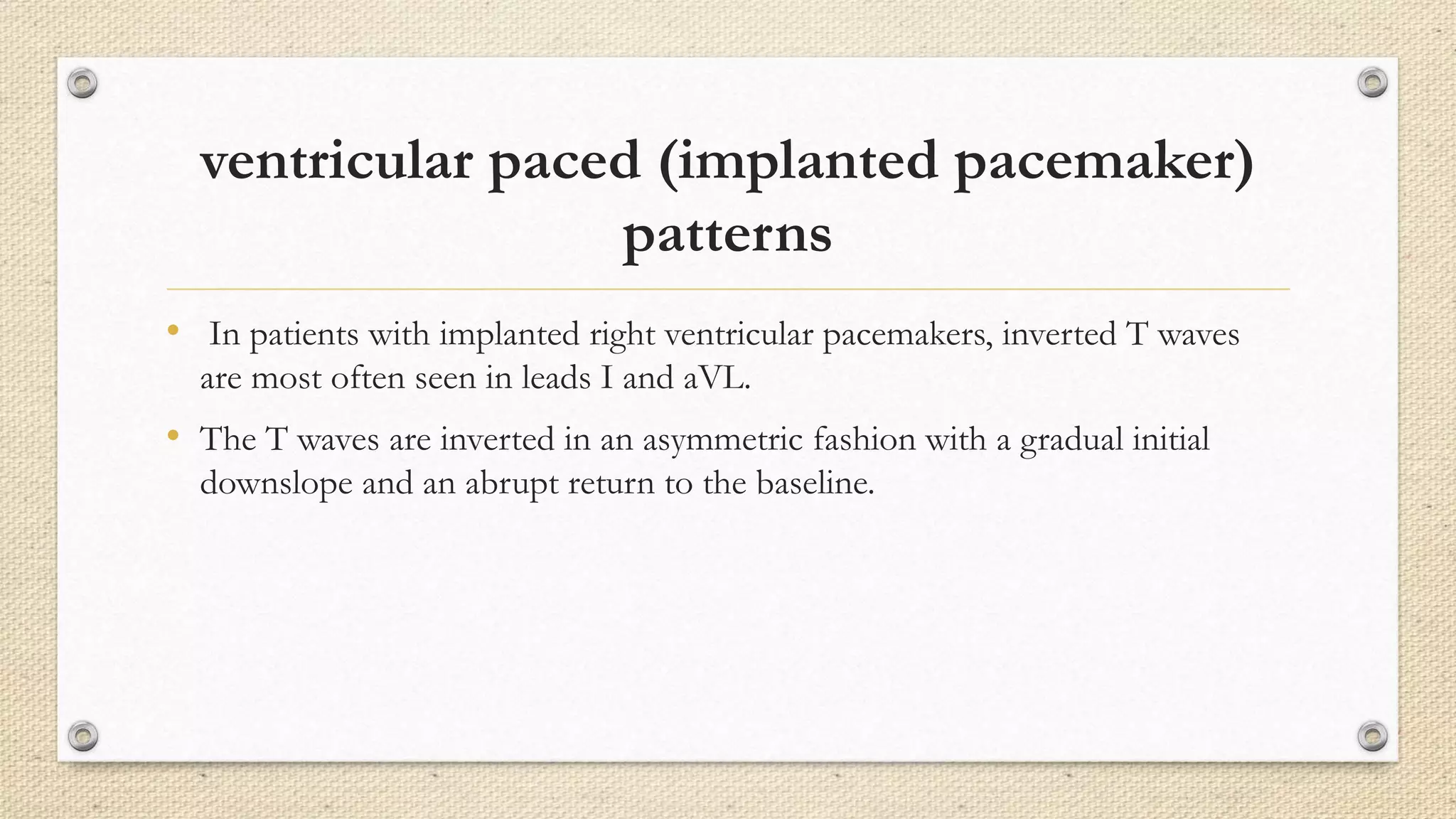 ECG-T wave inversion , Dr. Malala Rajapaksha ,Cardiology unit,General ...