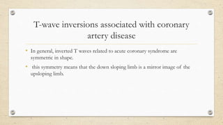 ECG-T wave inversion , Dr. Malala Rajapaksha ,Cardiology unit,General ...