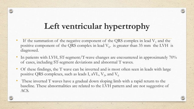 ECG-T wave inversion , Dr. Malala Rajapaksha ,Cardiology unit,General ...