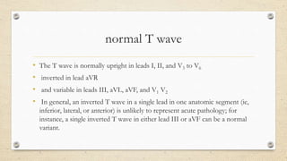 ECG-T wave inversion , Dr. Malala Rajapaksha ,Cardiology unit,General ...