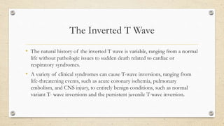 ECG-T wave inversion , Dr. Malala Rajapaksha ,Cardiology unit,General ...