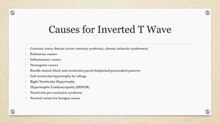 ECG-T wave inversion , Dr. Malala Rajapaksha ,Cardiology unit,General ...