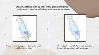 THE INVISALIGN aligner in orthodontics .pptx