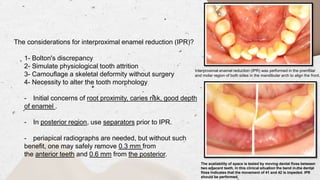 THE INVISALIGN aligner in orthodontics .pptx
