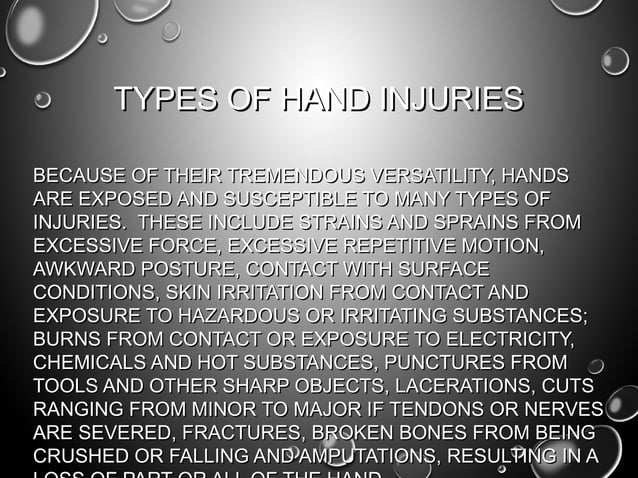The key to hand injury prevention | PPT