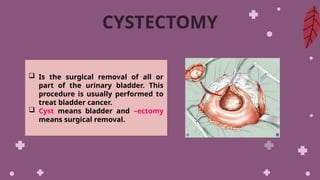 The kidneys................................... | PPT