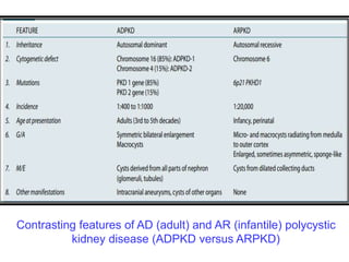 CONGENITAL MALFORMATIONS OF KIDNEY | PPT