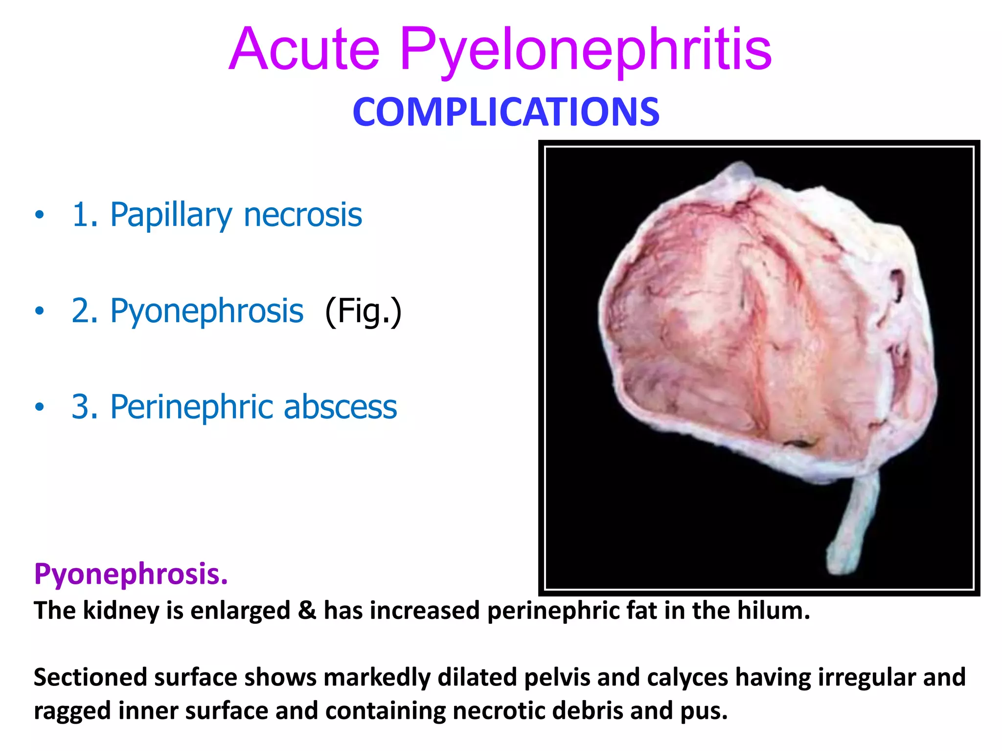 The kindney Diseases | PPTX