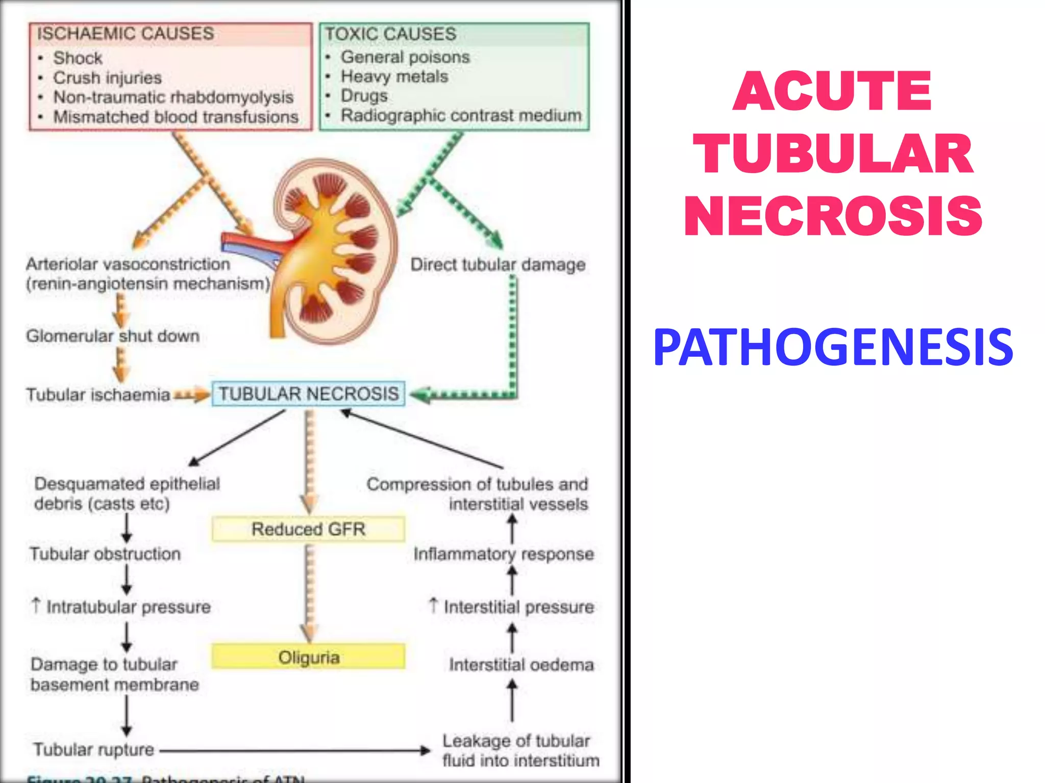 TUBULAR & TUBULOINTERSTITIAL DISEASES | PPTX