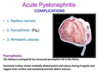 TUBULAR & TUBULOINTERSTITIAL DISEASES | PPTX