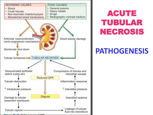 TUBULAR & TUBULOINTERSTITIAL DISEASES | PPTX