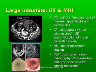 The large intestine | PPT