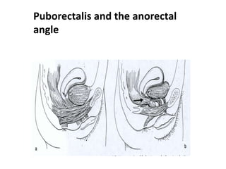 The Large Intestine. The Large Intestine. | PPT