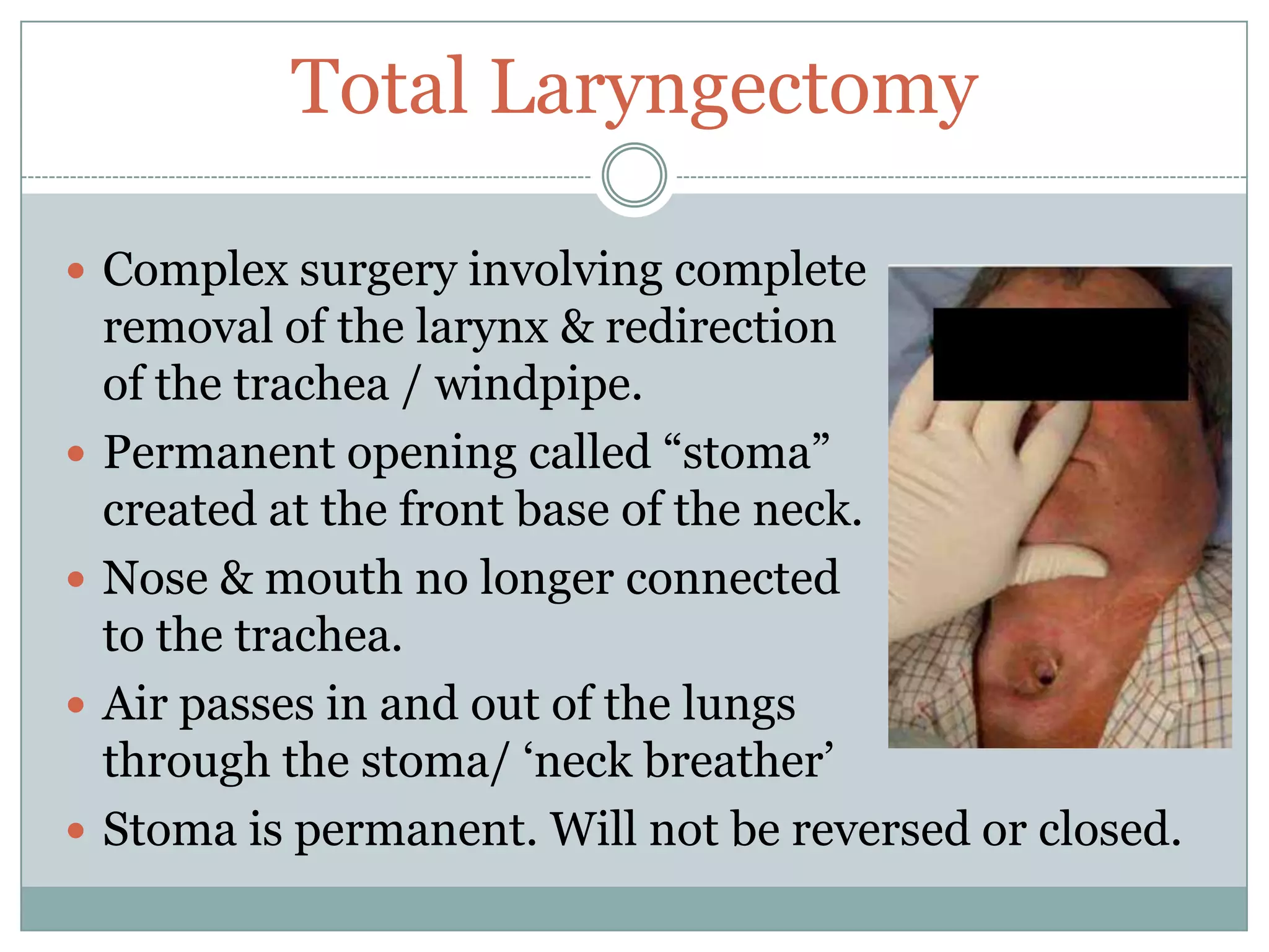 The laryngectomy patient | PPTX