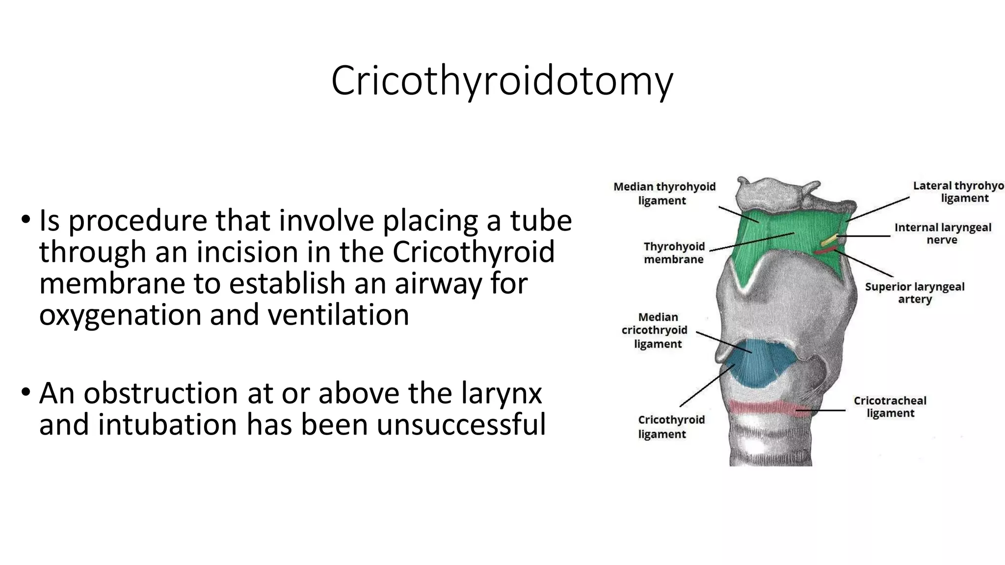 The larynx.pptx