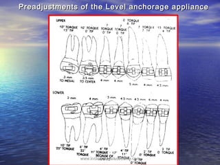 The level anchorage system | PPT