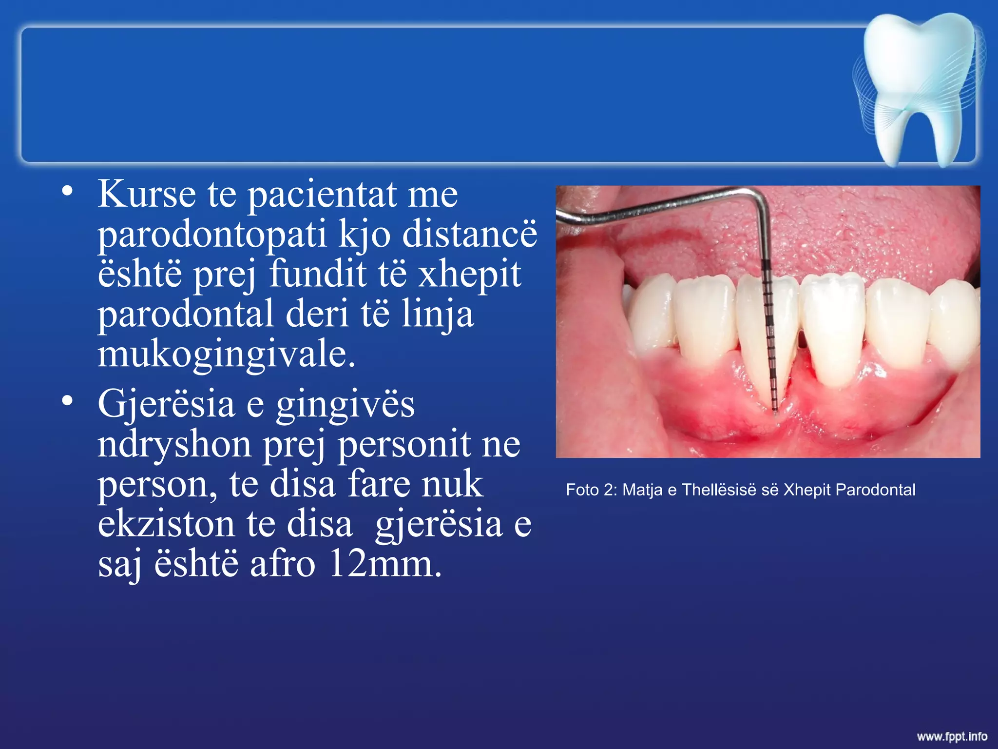 Thellimi i vestibullumit | PPT