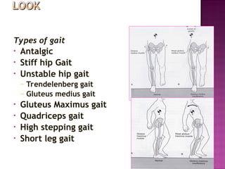 THE LOCOMOTOR SYSTEM is a system of structures that move the body | PPT