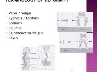 THE LOCOMOTOR SYSTEM is a system of structures that move the body | PPT
