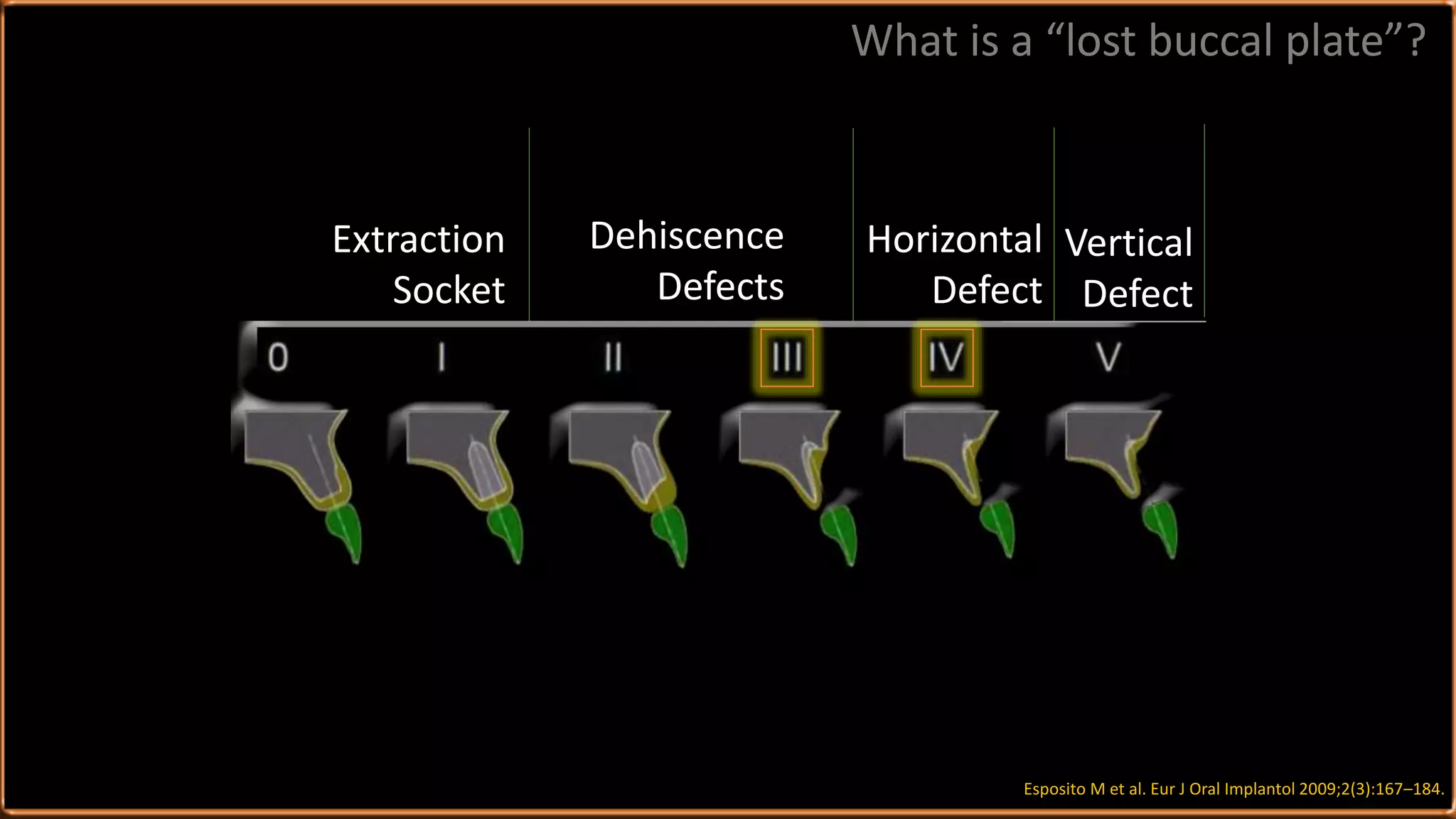The lost buccal plate | PPTX
