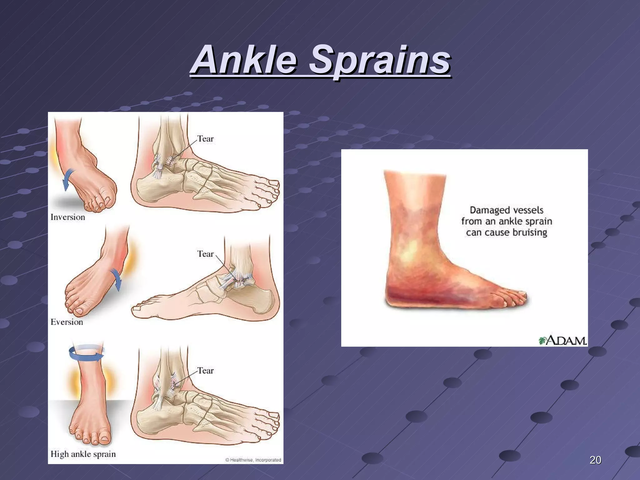 The lower leg and ankle f09 | PPT