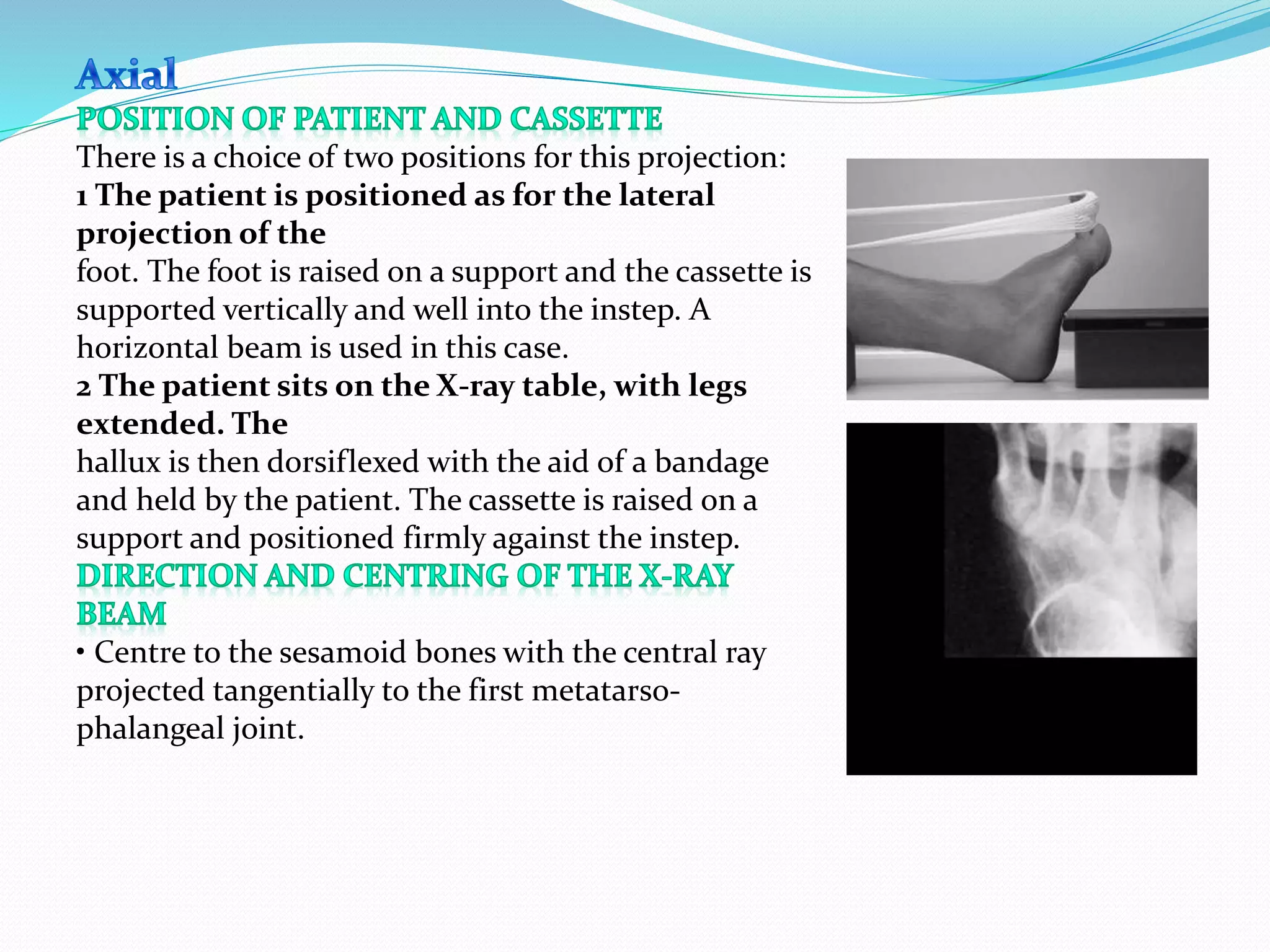the lower limb positioning | PPTX