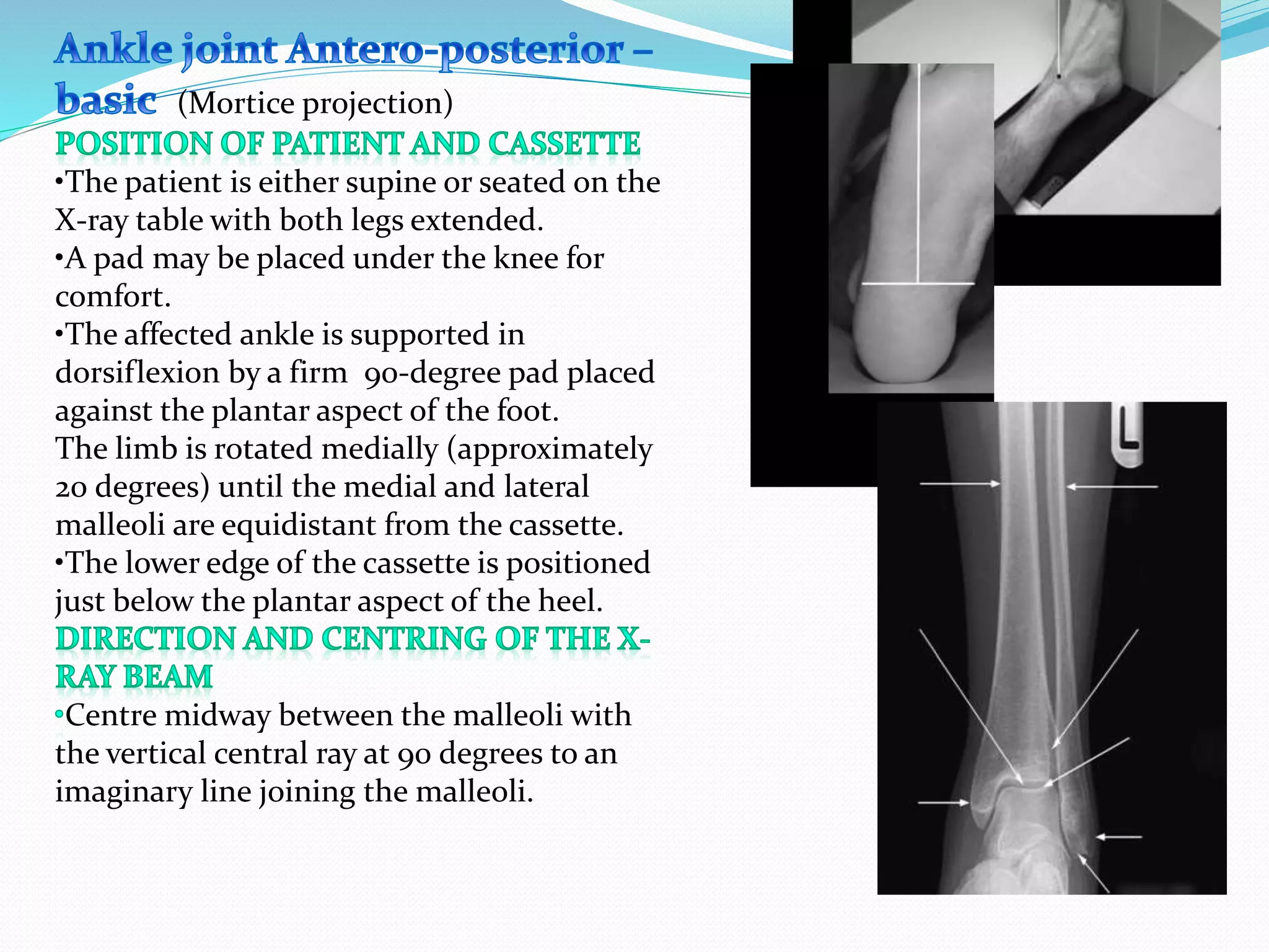 the lower limb positioning | PPTX