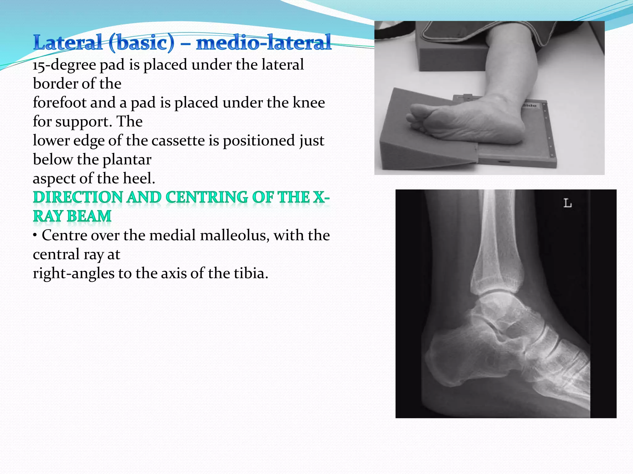 the lower limb positioning | PPTX