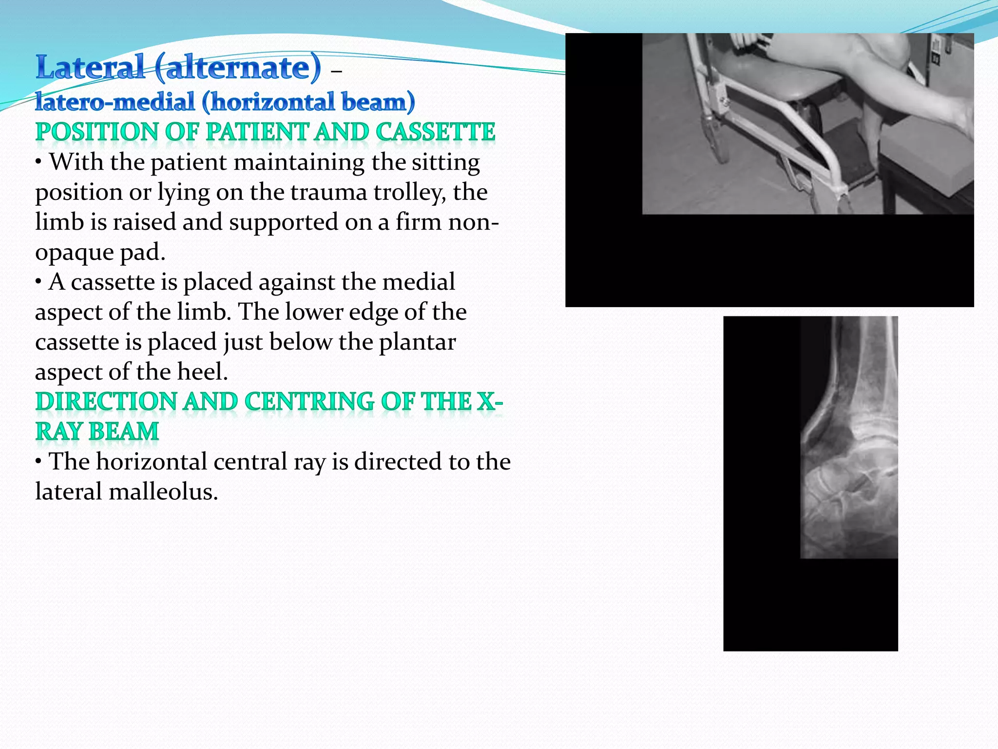 the lower limb positioning | PPTX