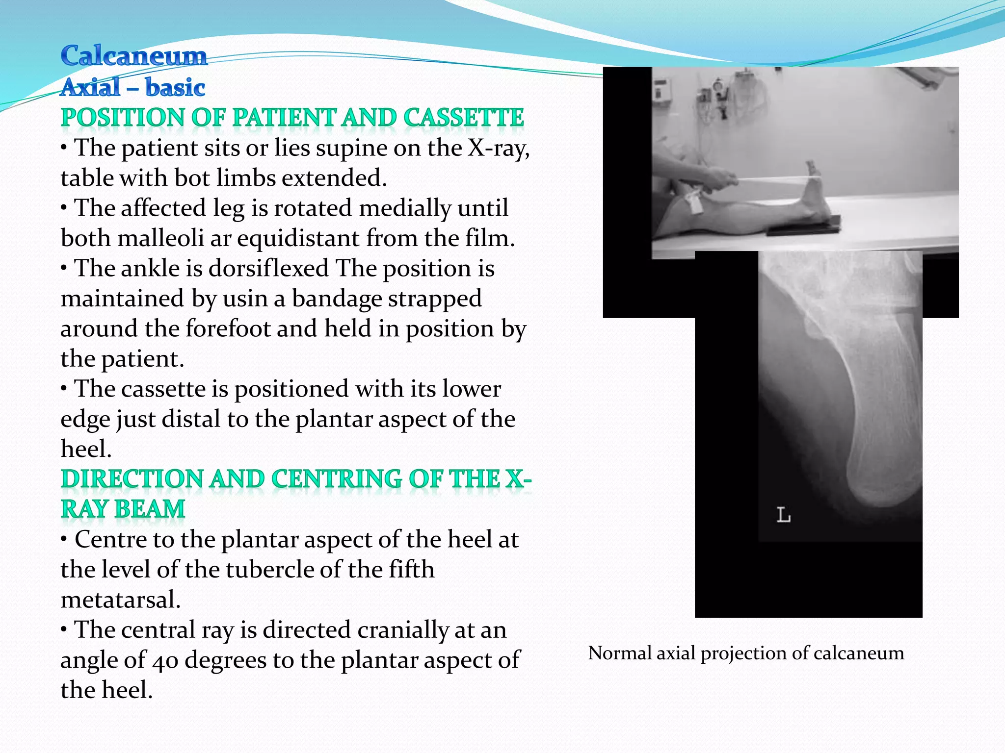 the lower limb positioning | PPTX