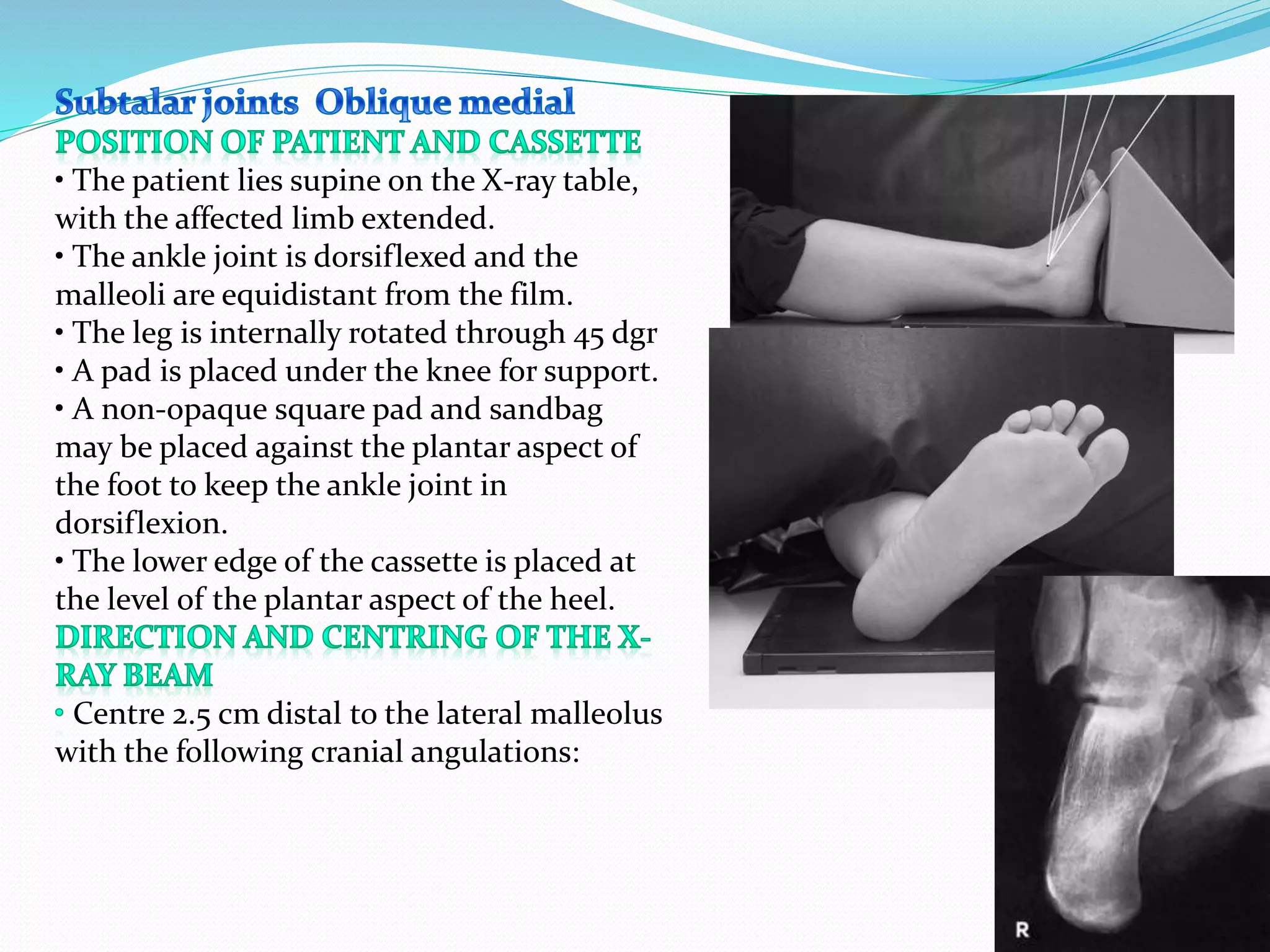 the lower limb positioning | PPTX