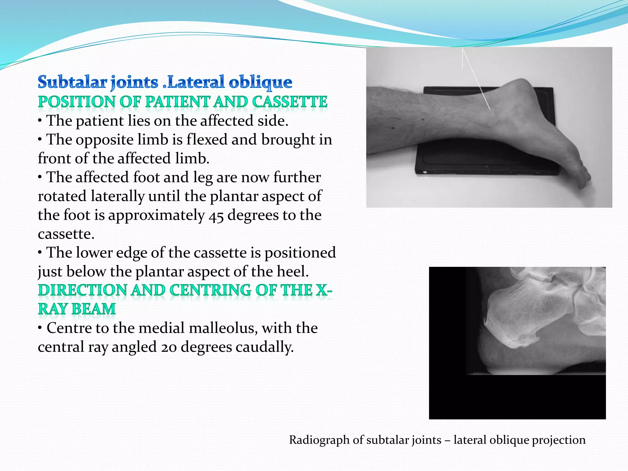 the lower limb positioning | PPTX