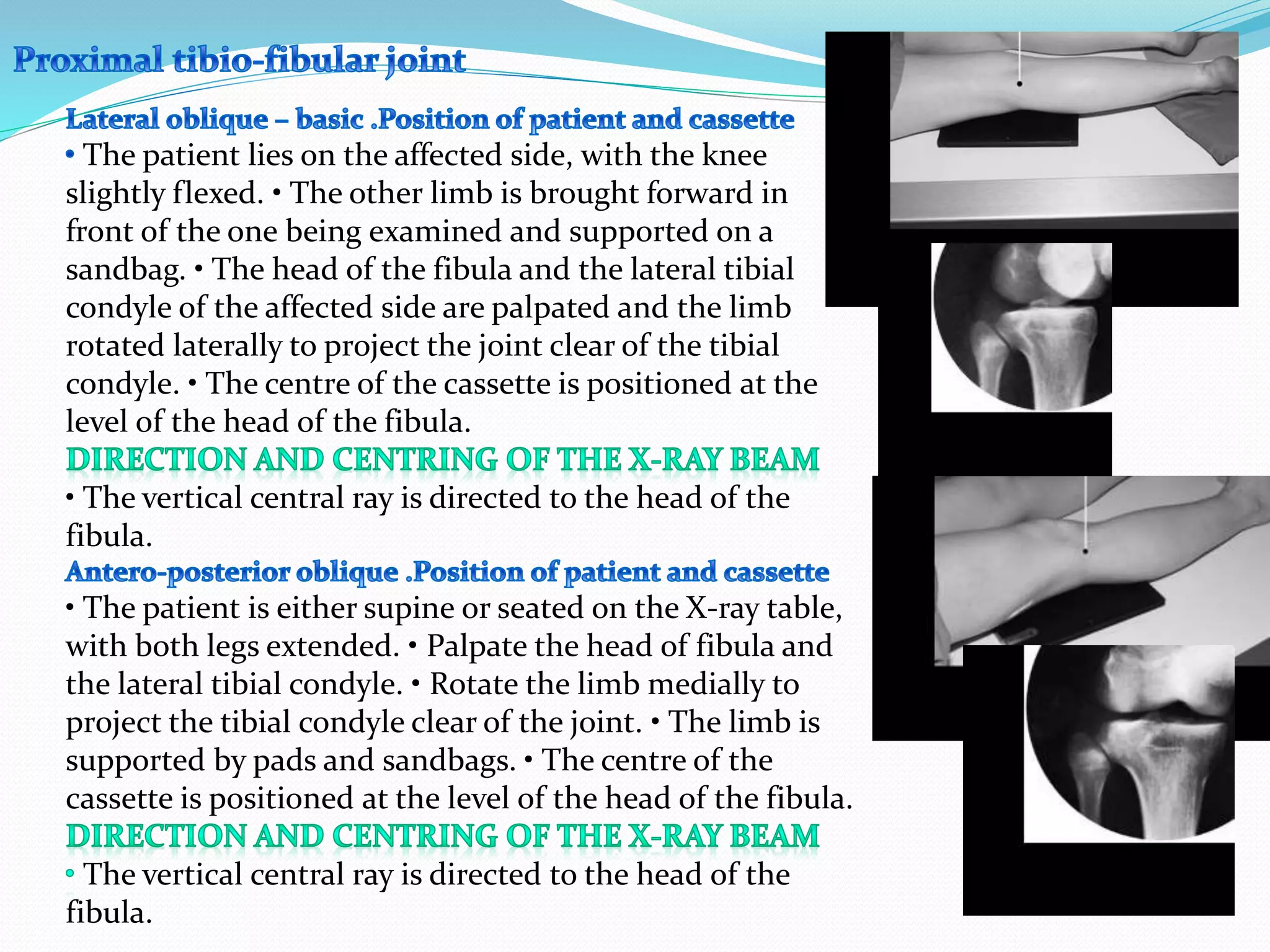 the lower limb positioning | PPTX