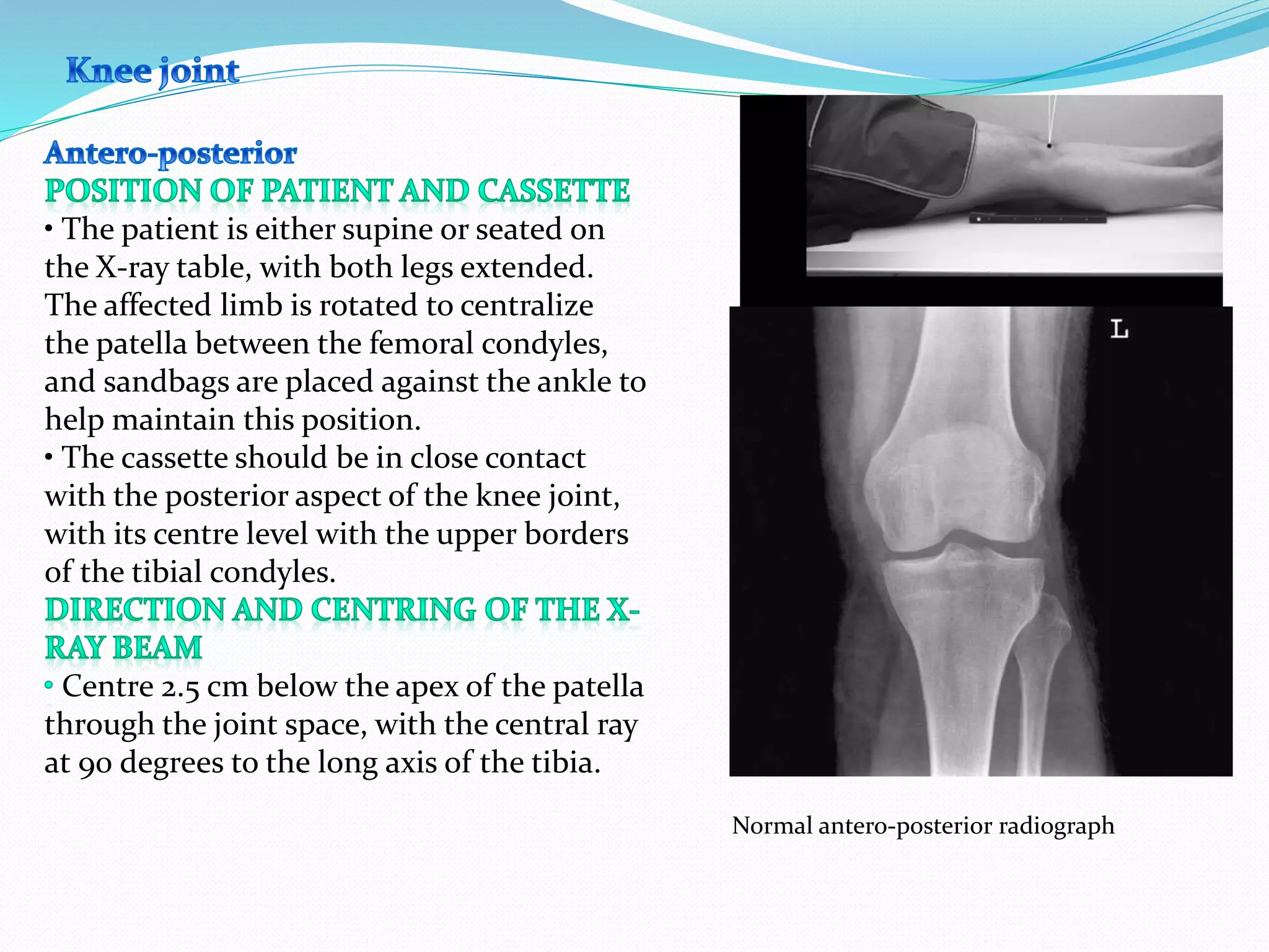 the lower limb positioning | PPTX