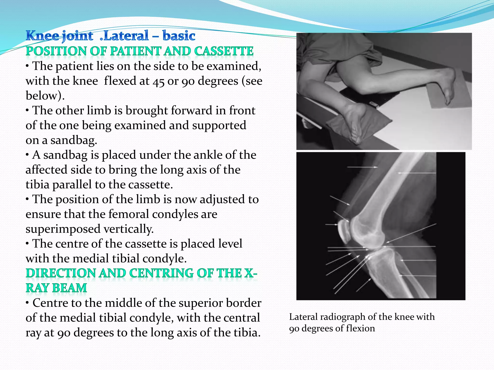 the lower limb positioning | PPTX