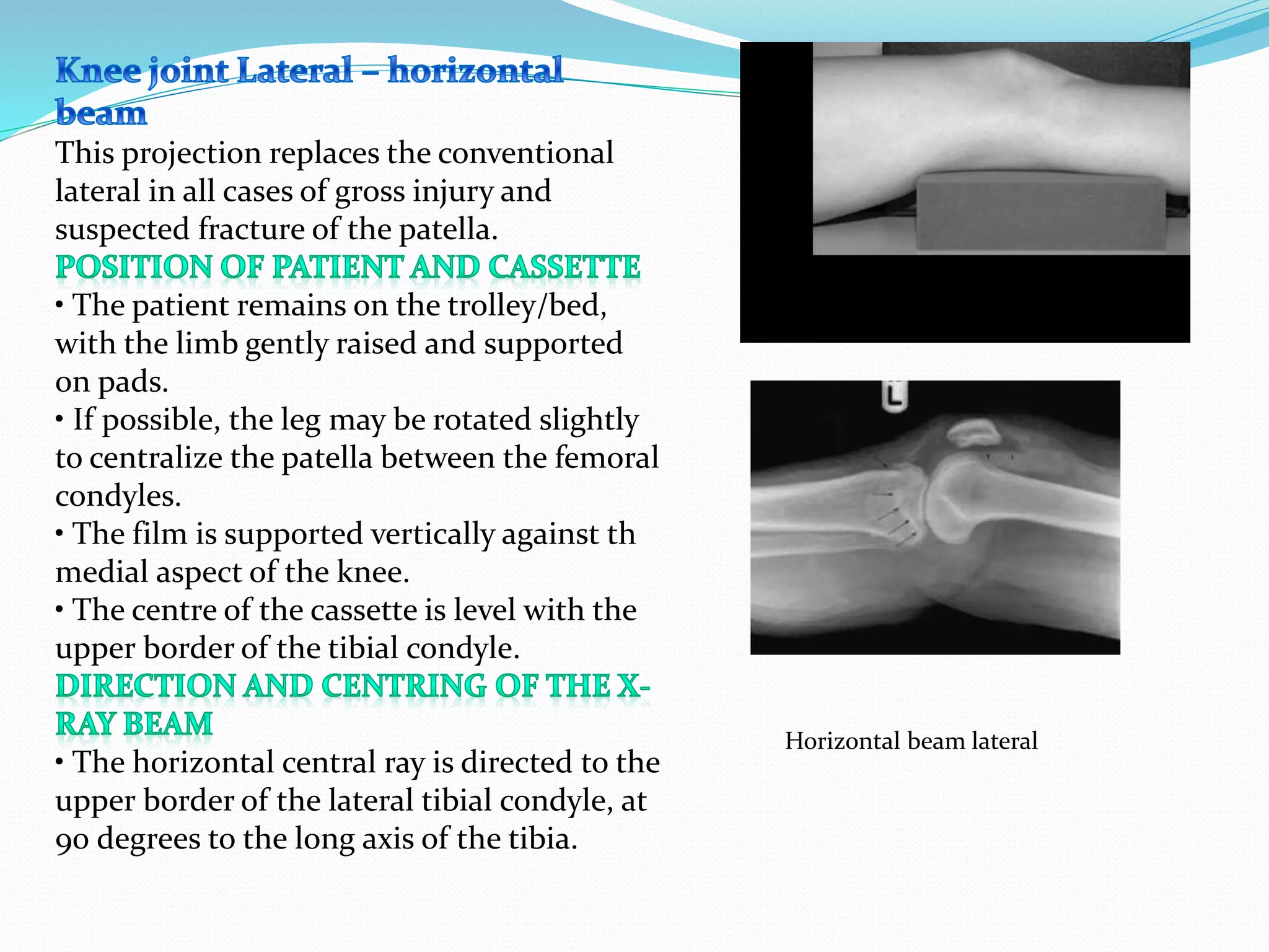 the lower limb positioning | PPTX