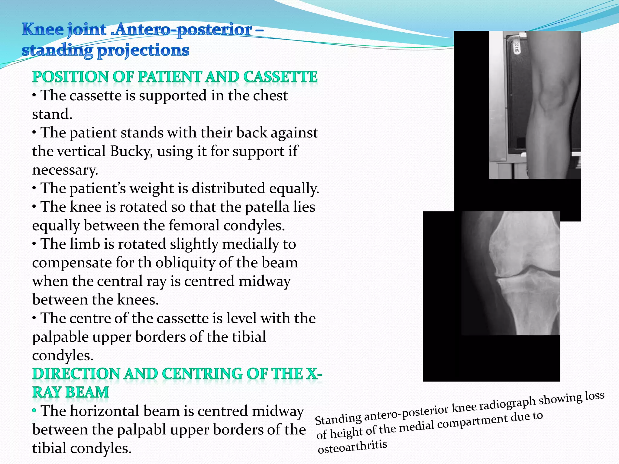 the lower limb positioning | PPTX