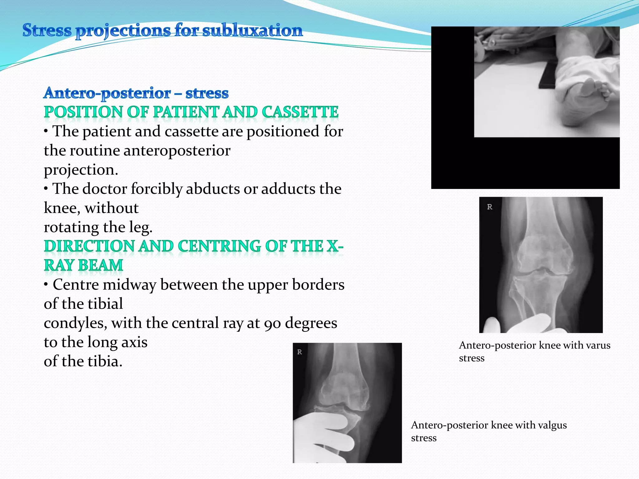 the lower limb positioning | PPTX