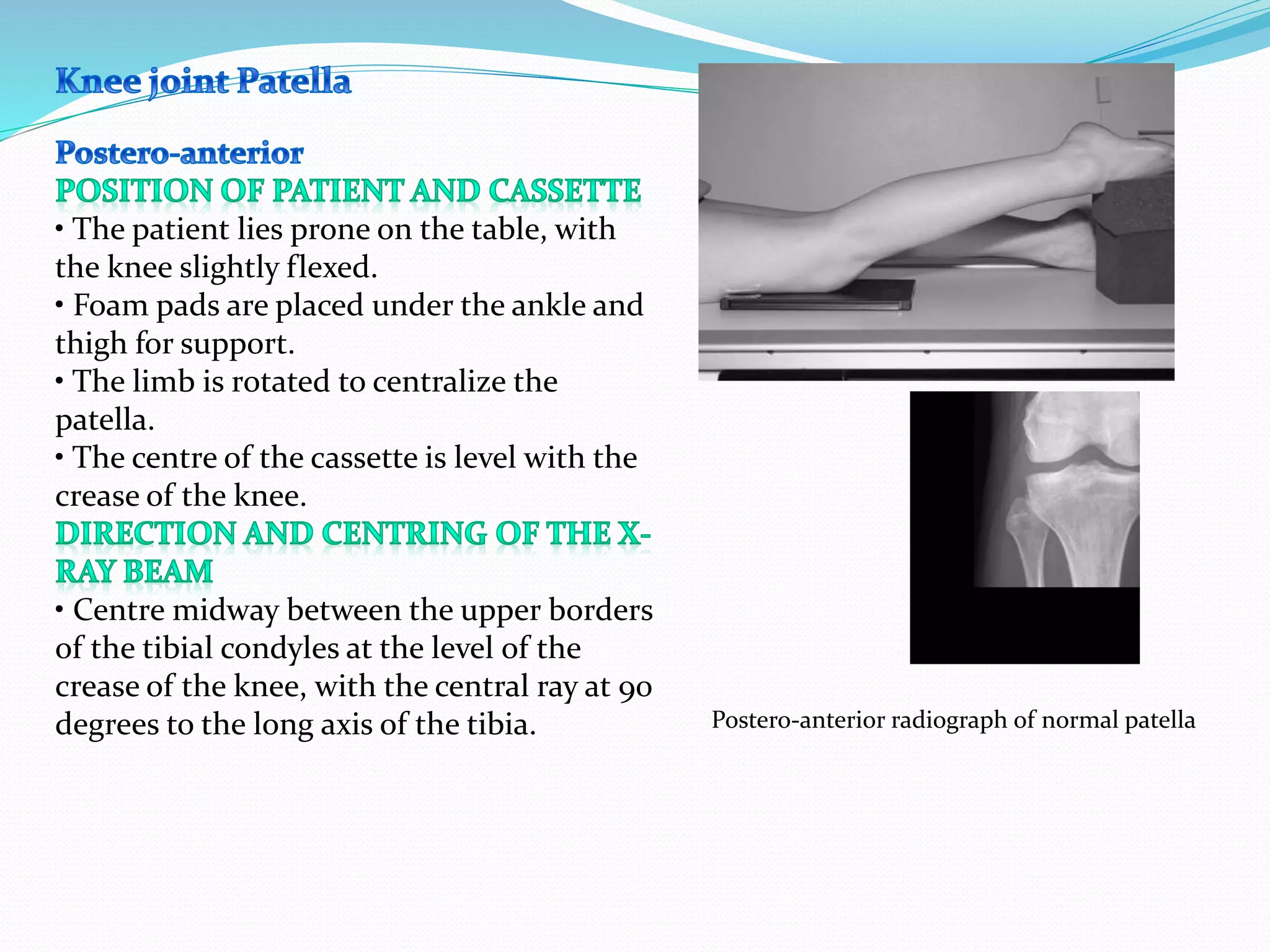 the lower limb positioning | PPTX