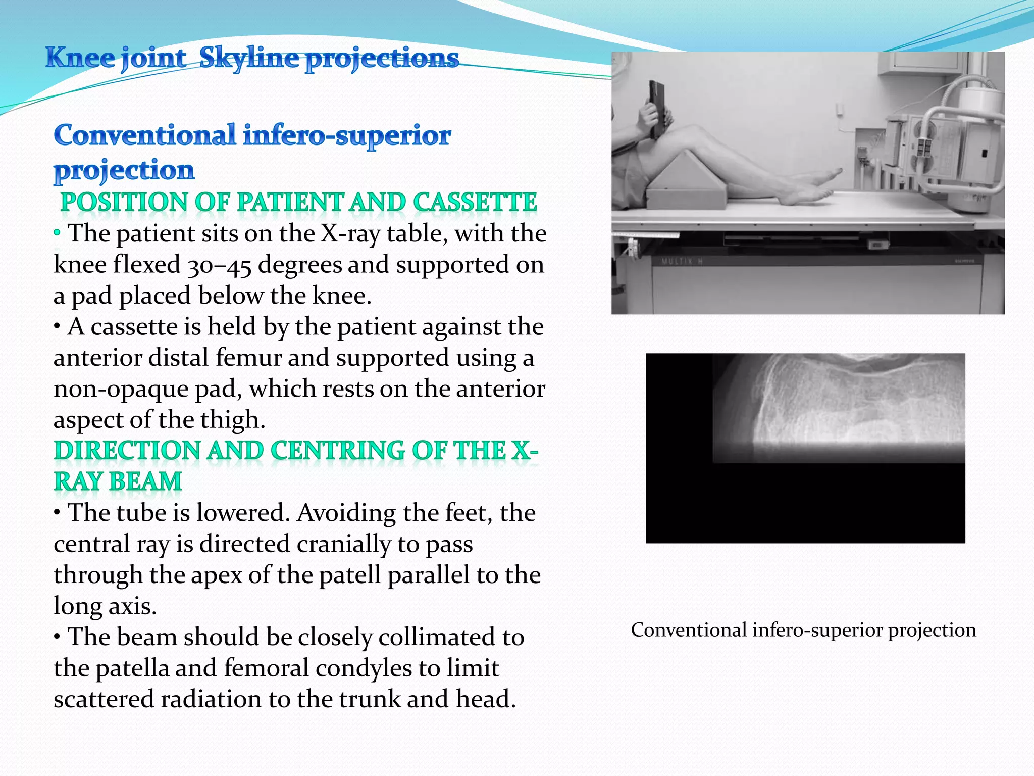 the lower limb positioning | PPTX