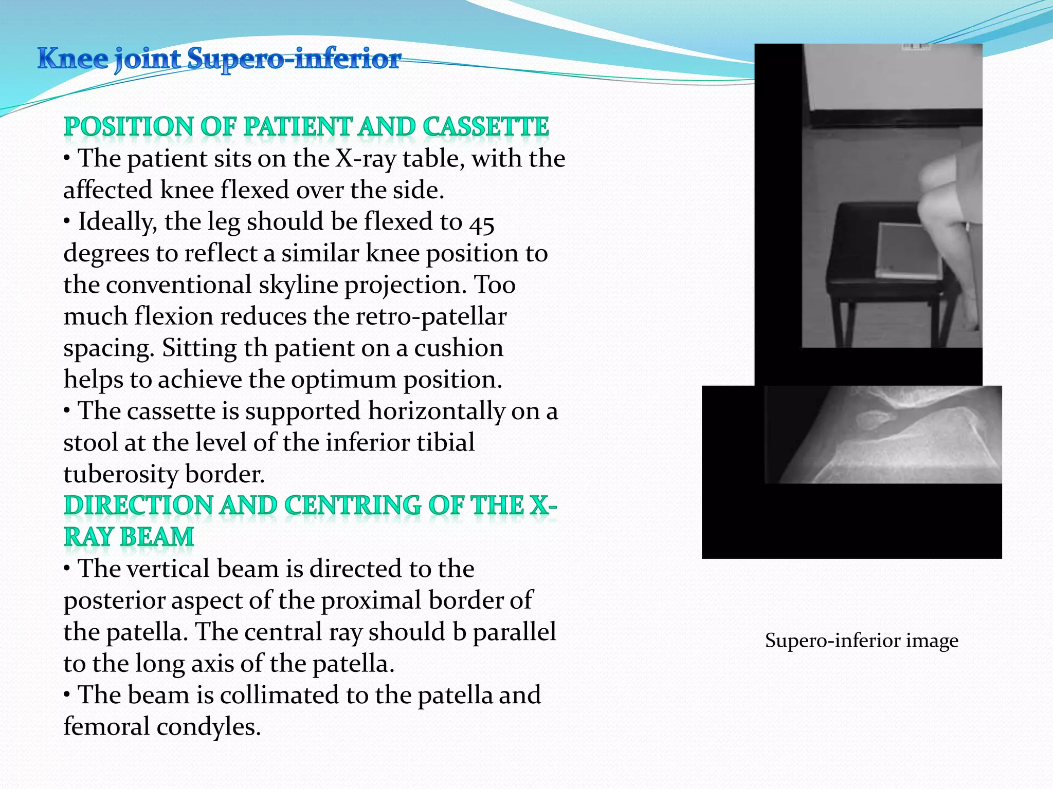 the lower limb positioning | PPTX