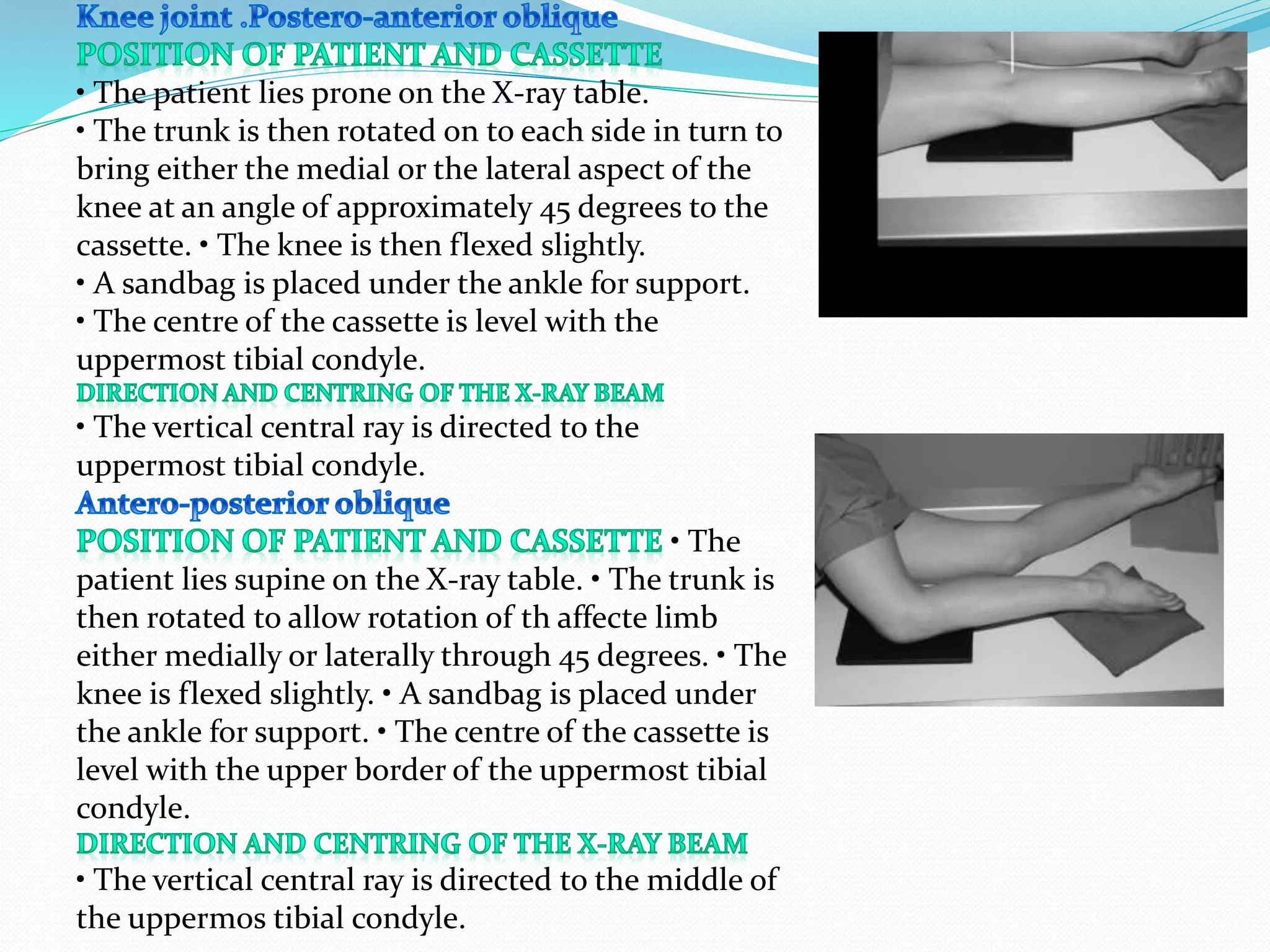 the lower limb positioning | PPTX