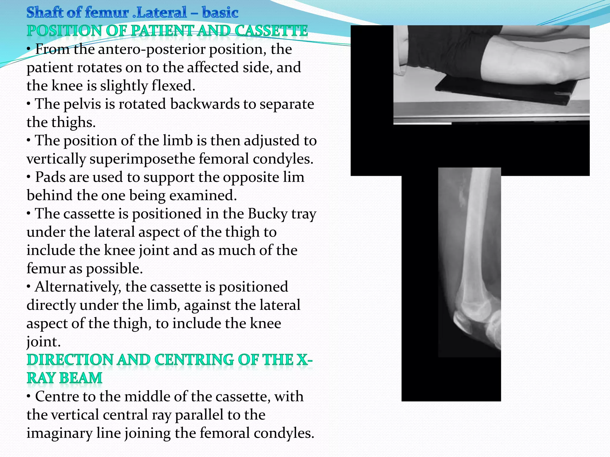 the lower limb positioning | PPTX