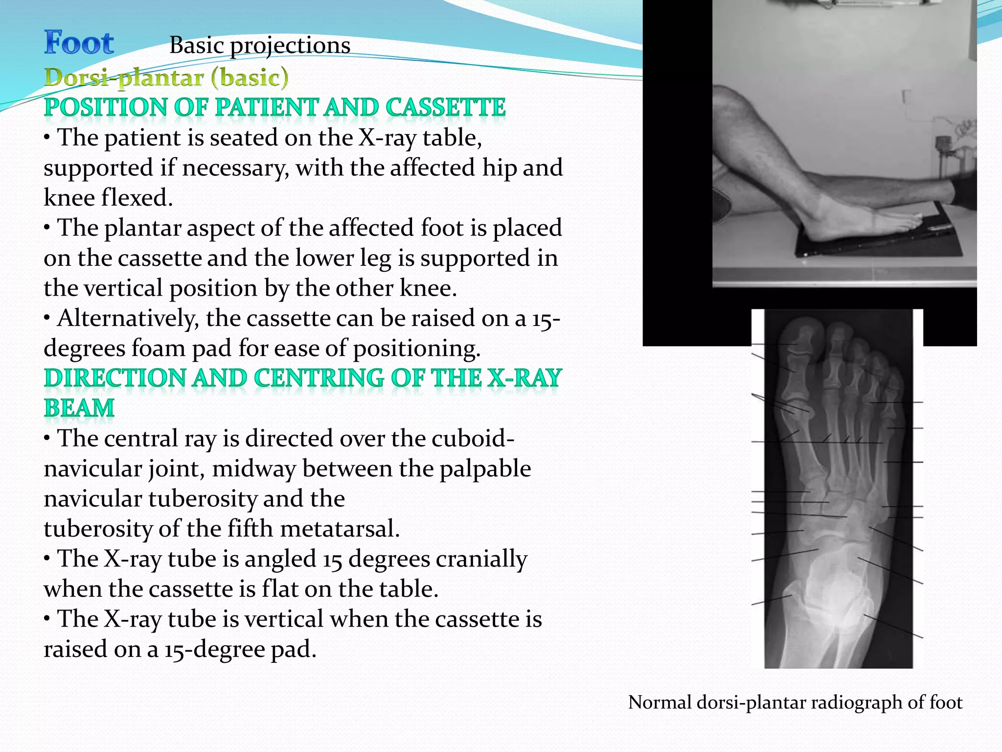 the lower limb positioning | PPTX