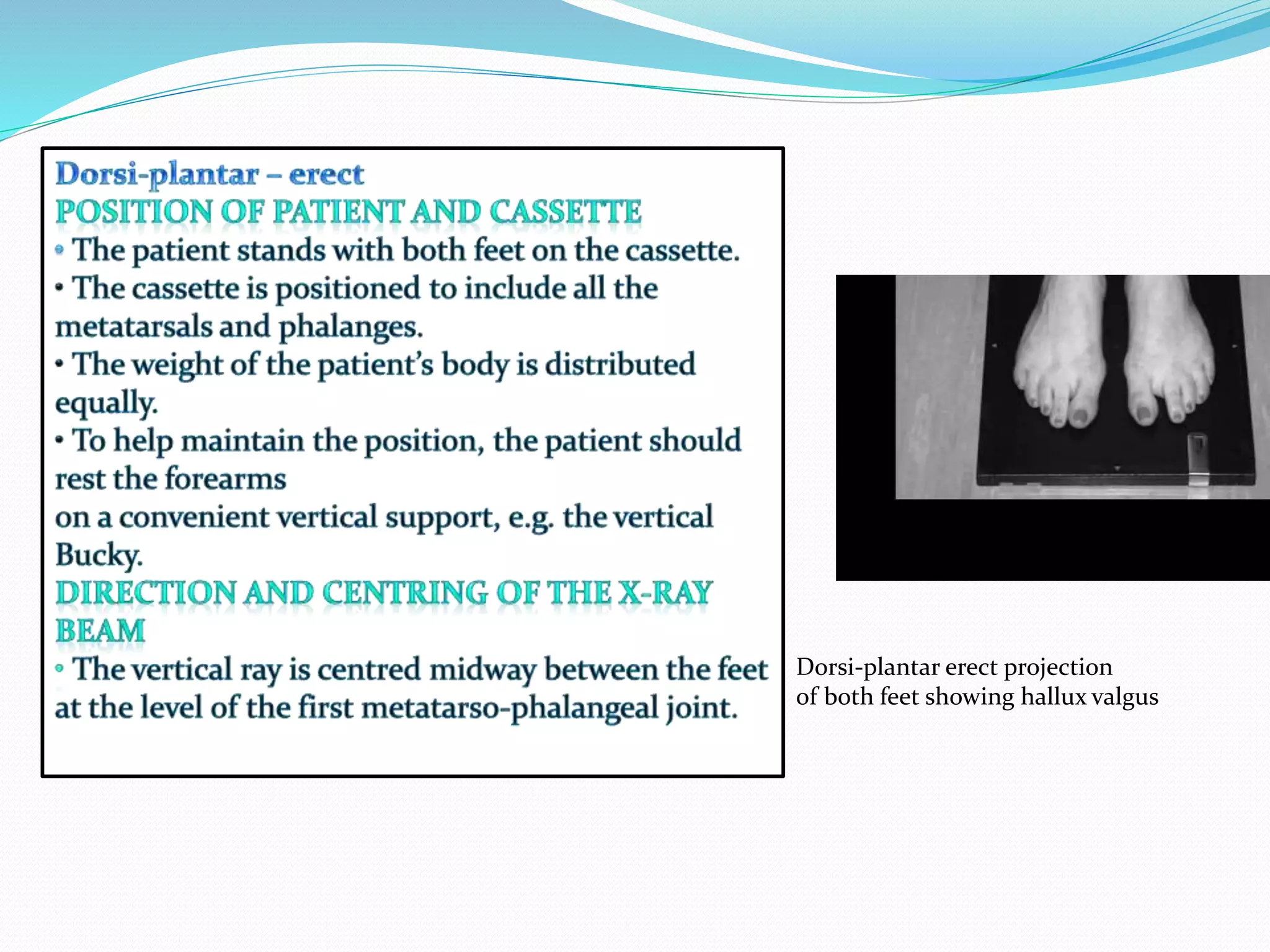 the lower limb positioning | PPTX