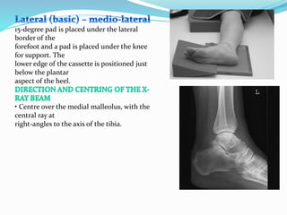 the lower limb positioning | PPTX